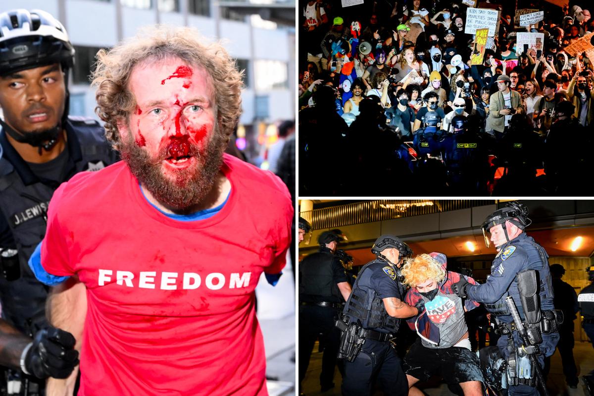 Bloody brawl breaks out as agitators protest TPUSA event at UC Berkeley ...